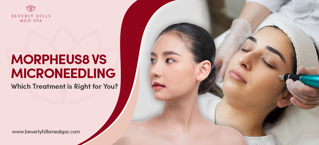 Morpheus8 Vs Microneedling Beverly Hills Med Spa
